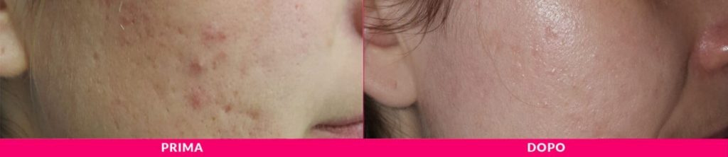 Trattamenti Laser Viso all'Avanguardia | Clinica del Viso